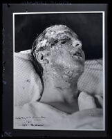 Copy Of Grand Jury Exhibit Photograph Of Darby Day Jr S Facial Acid