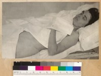 Morgue photograph of Virginia Rappe — Calisphere
