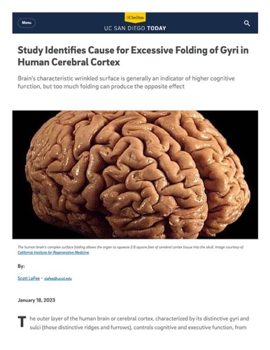 Study Identifies Cause for Excessive Folding of Gyri in Human Cerebral ...