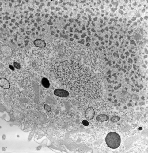 CIL:39242, uncultured scuticociliate, Conchophthirus curtus, cell by ...