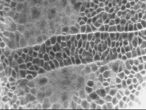 CIL:35411, Danio rerio, neurecto-epithelial cell — Calisphere