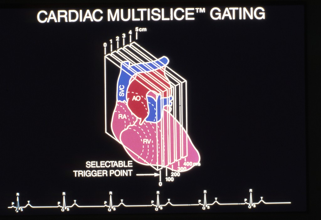 MRI Cardiac Multislice Gating diagram — Calisphere