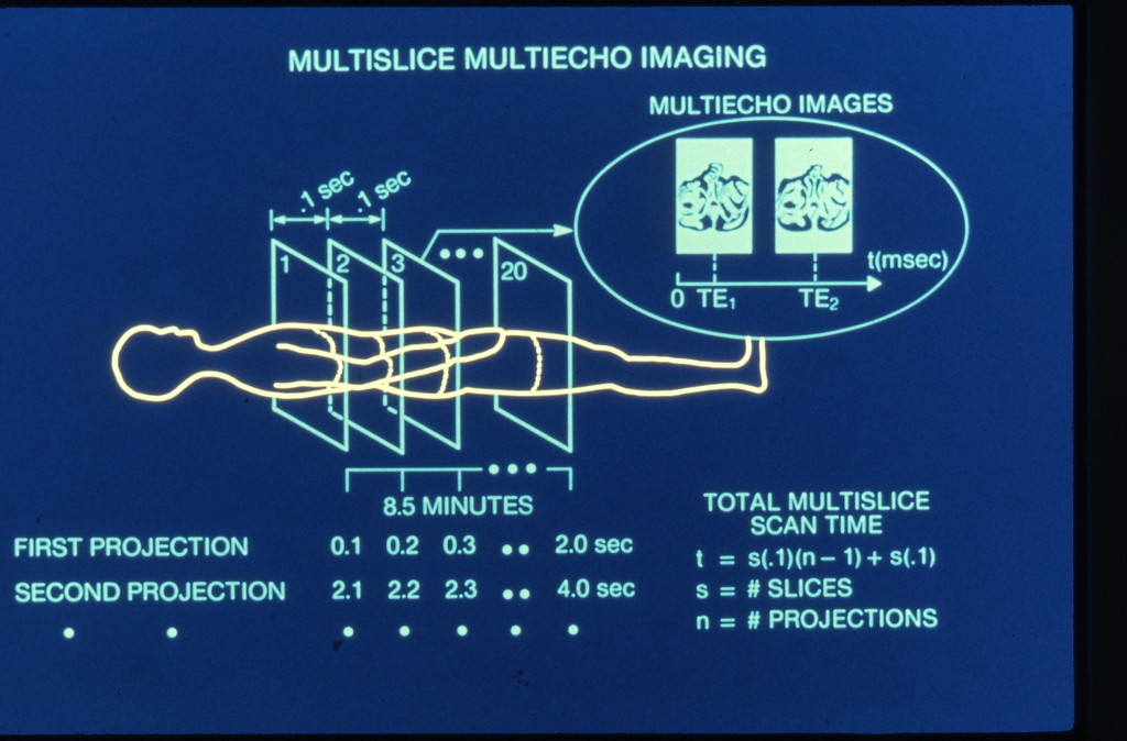 MRI Multislice Multiecho Imaging diagram — Calisphere