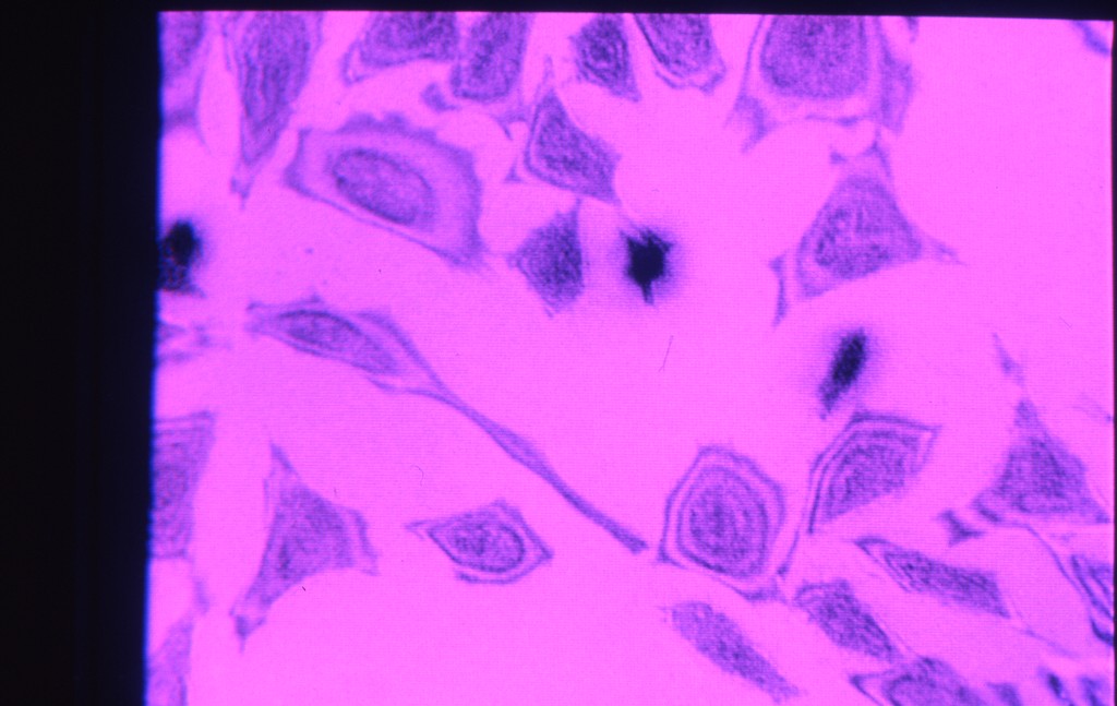 Ultrasound Microscope Images — Calisphere