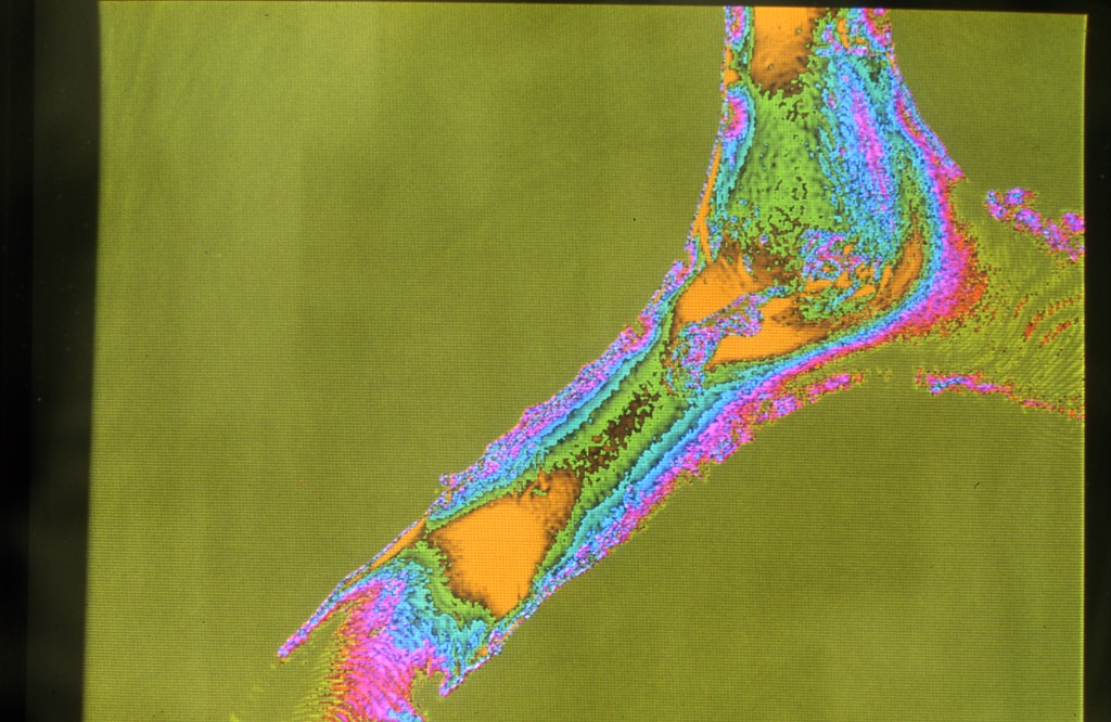 Ultrasound Microscope Images — Calisphere